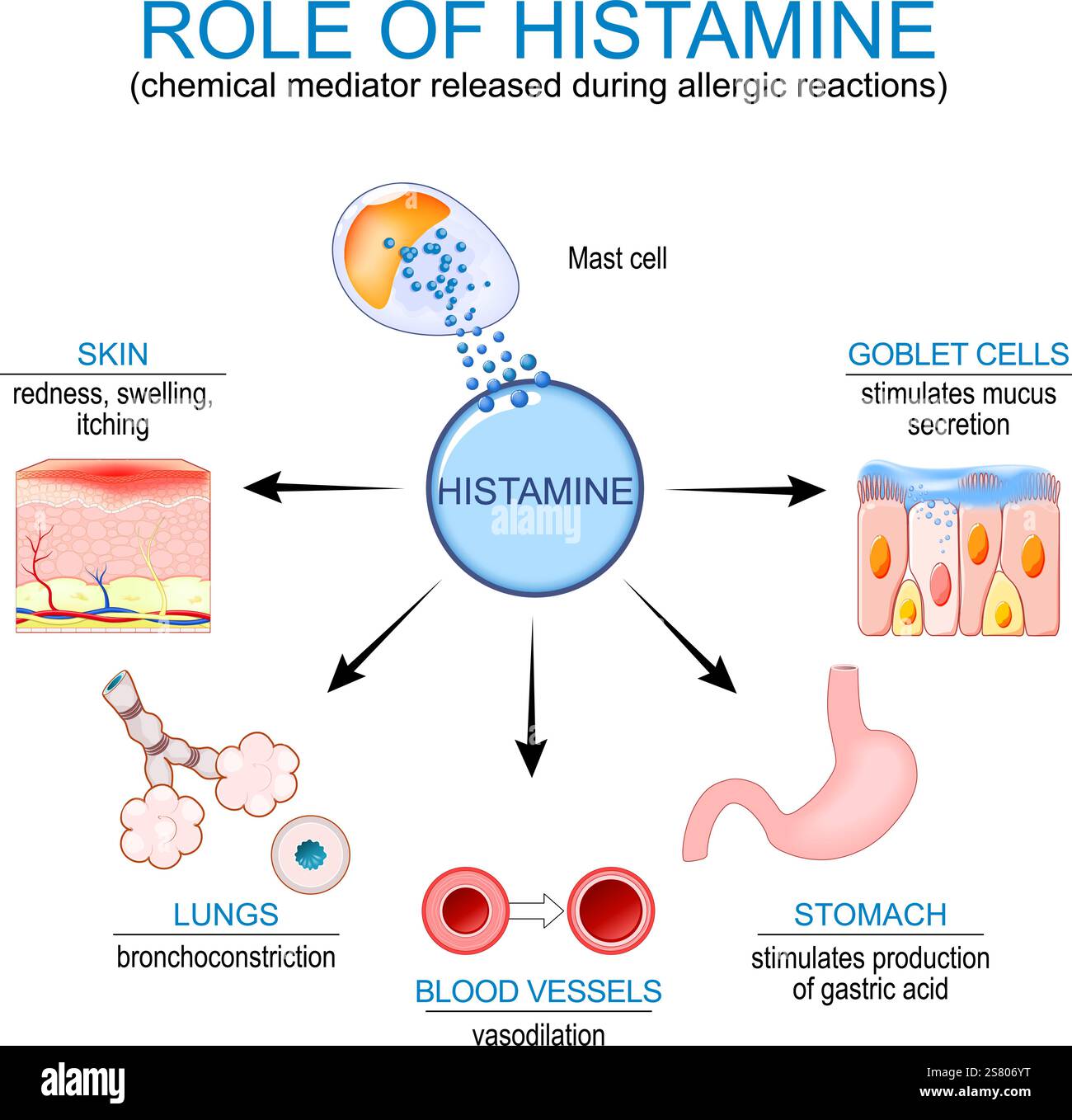 Allergic Reaction Diagram