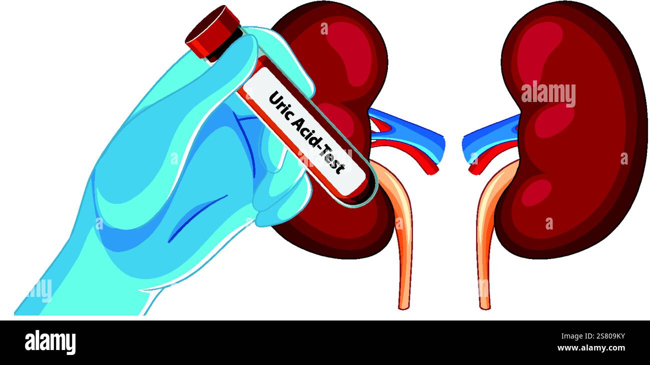 Illustration of kidneys and uric acid test tube Stock Vector Image ...