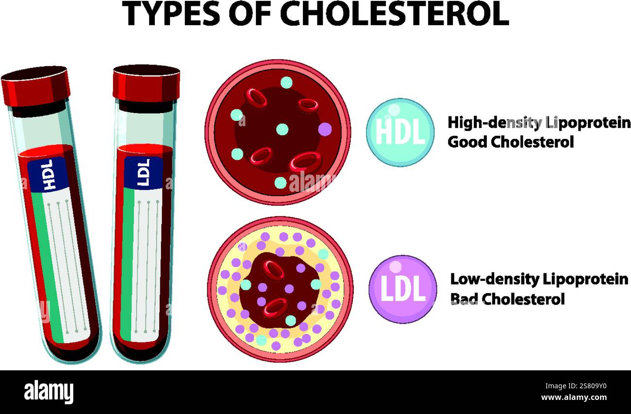 Illustration of HDL and LDL cholesterol differences Stock Vector Image & Art - Alamy