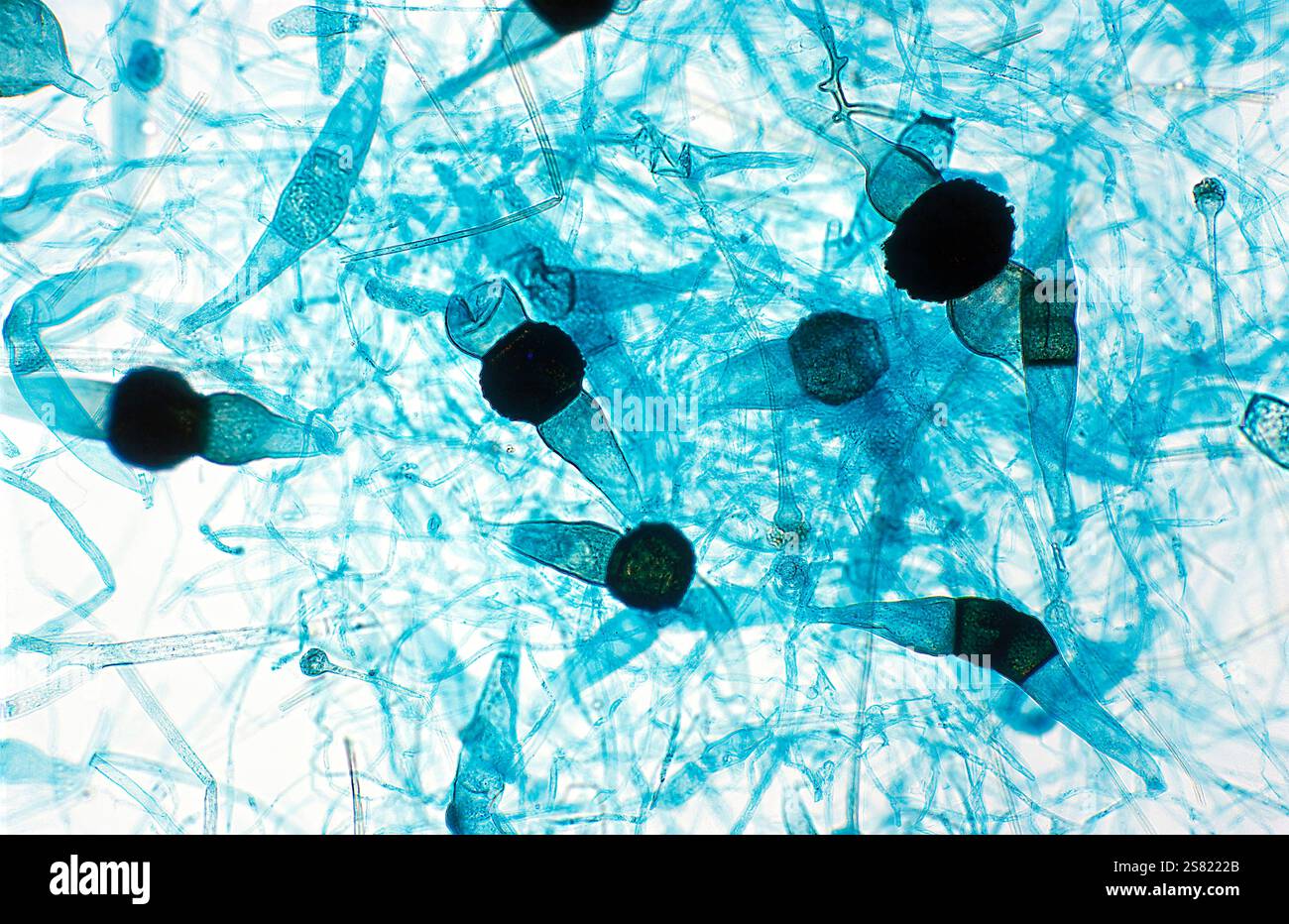 Black Bread Mold (Rhizopus nigrans) Micrograph at 50x Stock Photo - Alamy