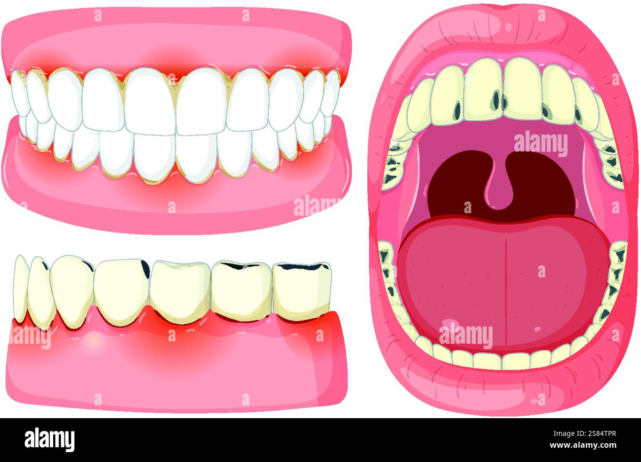 Human teeth molars anatomy Cut Out Stock Images & Pictures - Alamy