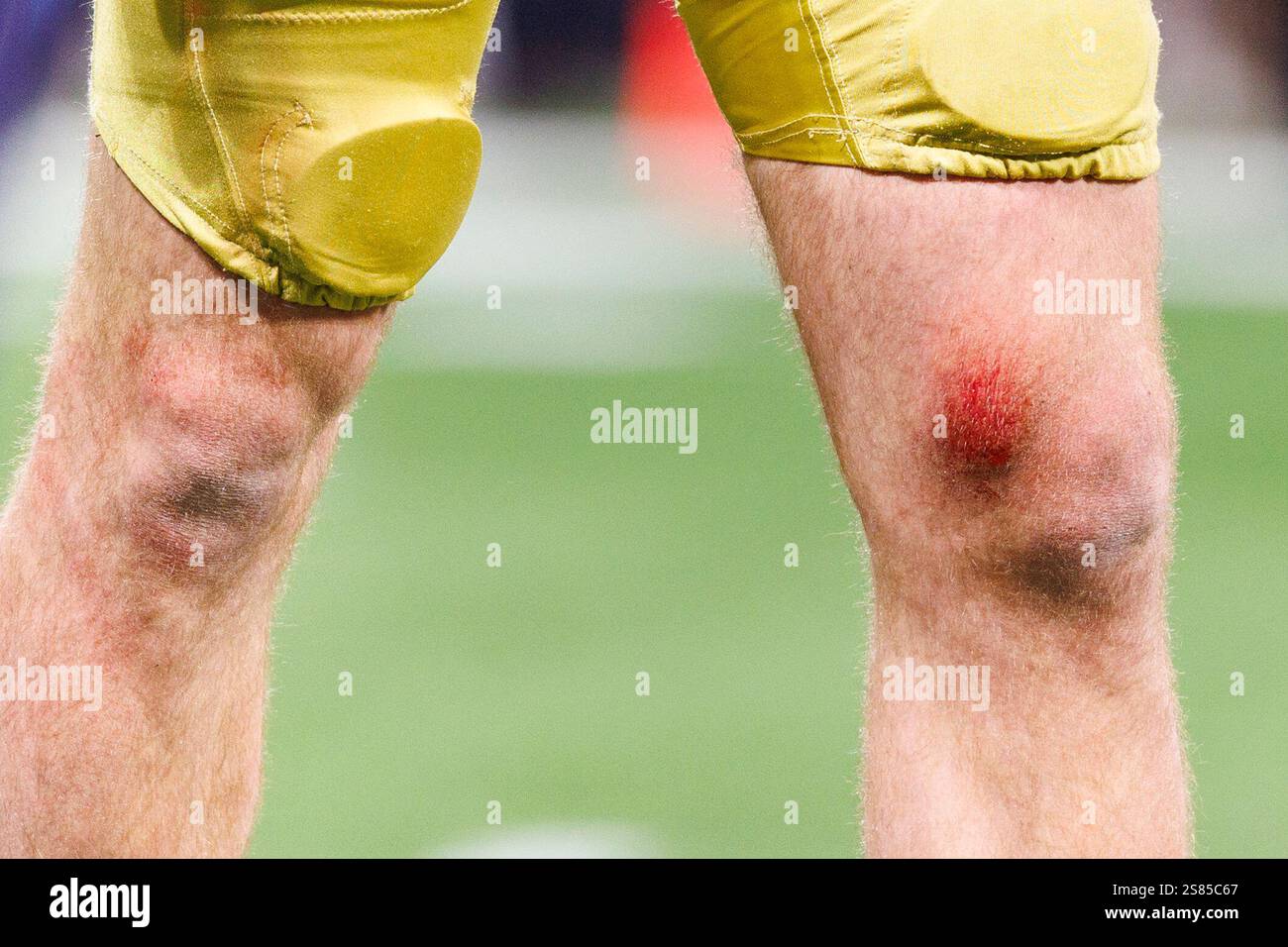 January 20, 2025: The knees of Notre Dame quarterback Riley Leonard (13 ...