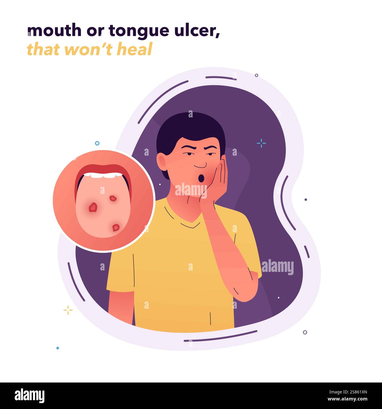 Wound cavity vector vectors hi-res stock photography and images - Alamy