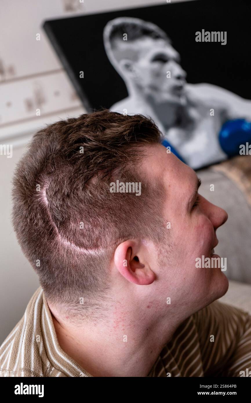 Shot in 2019. Boxer Nick Blackwell who ended up in coma after fighting ...