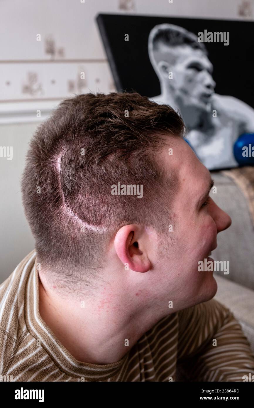 Shot in 2019. Boxer Nick Blackwell who ended up in coma after fighting ...