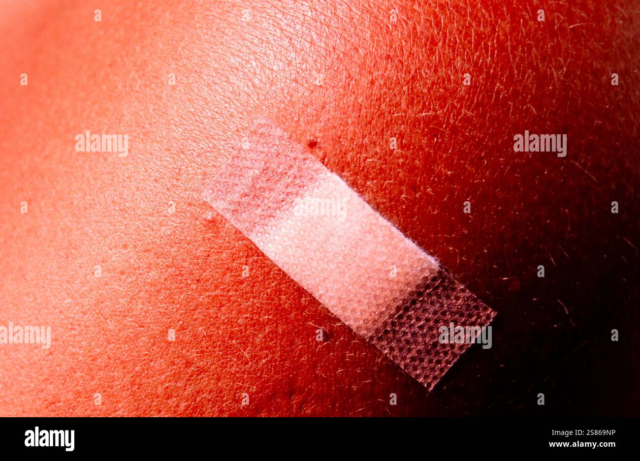 Skin plaster hi-res stock photography and images - Alamy
