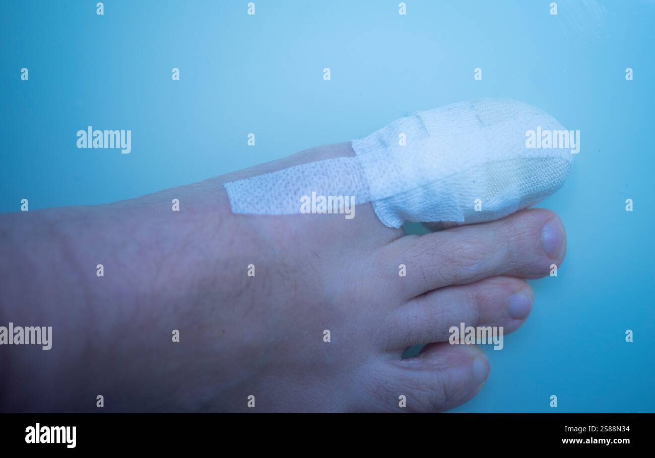 Foot big toe bandage injured feet in medical clinic hospital center ...