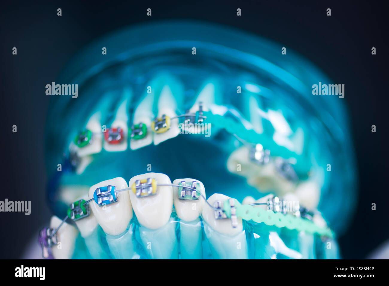 Dental teeth aligner bracket teaching student model showing gums and ...