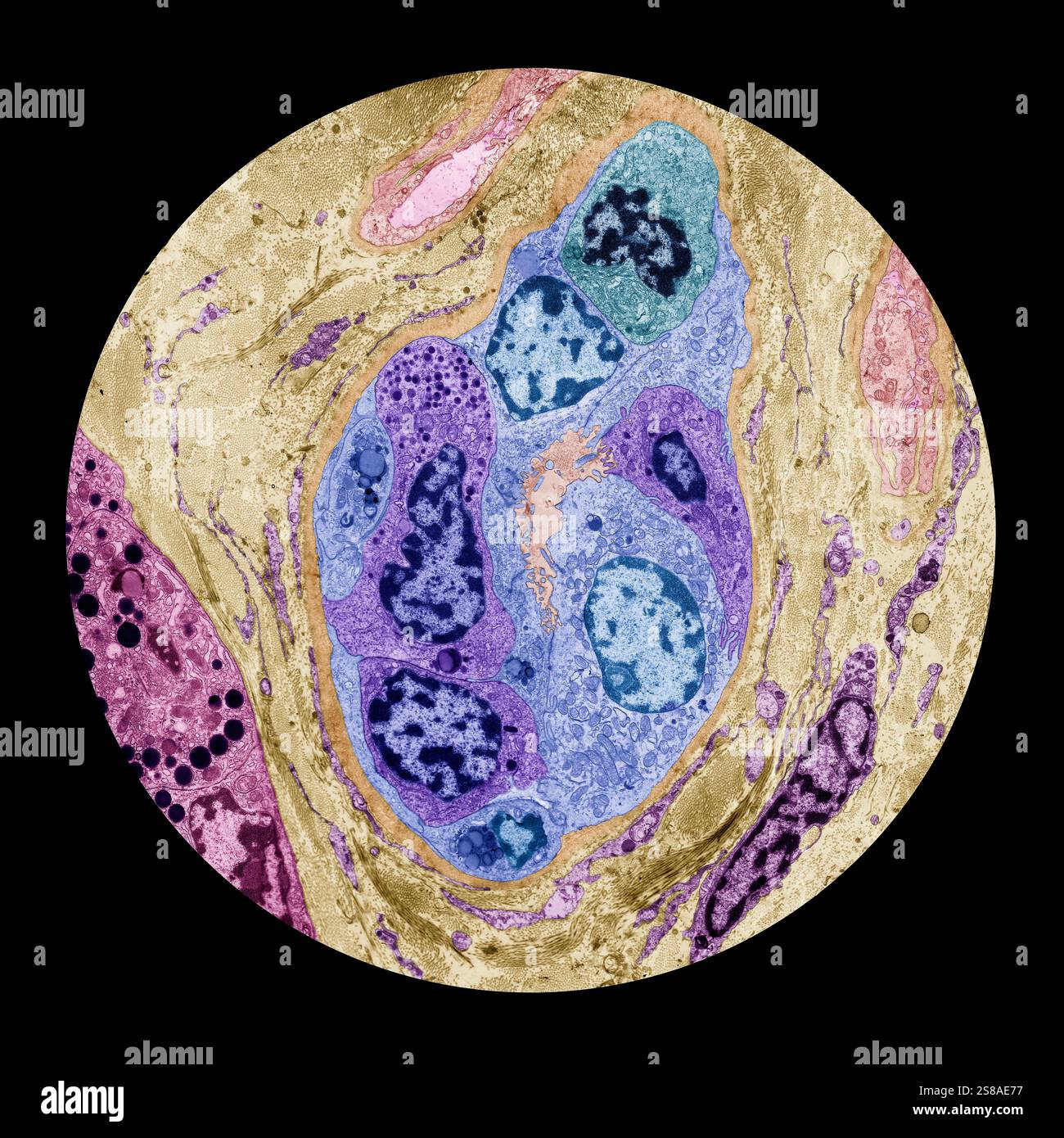 Pancreatic tissue. Coloured transmission electron micrograph (TEM) of a ...