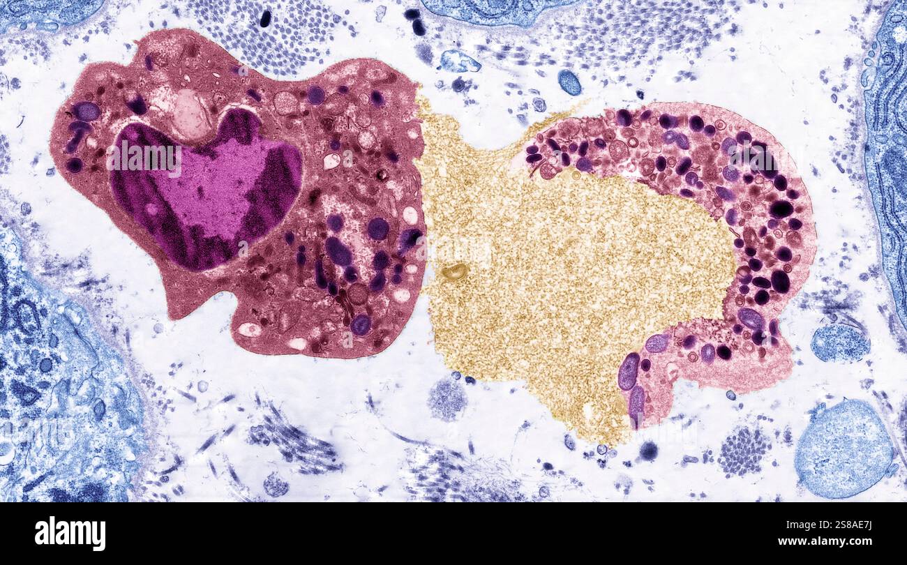 Pancreatic tissue. Coloured transmission electron micrograph (TEM) of a ...