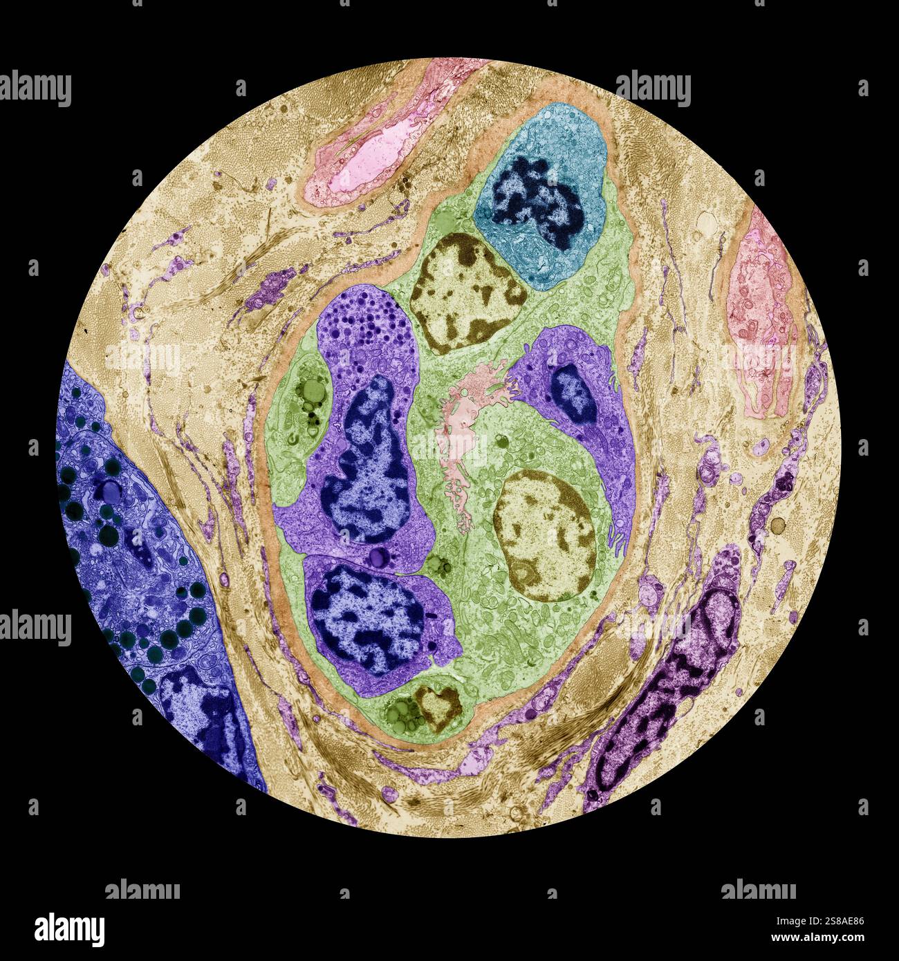 Pancreatic tissue. Coloured transmission electron micrograph (TEM) of a ...