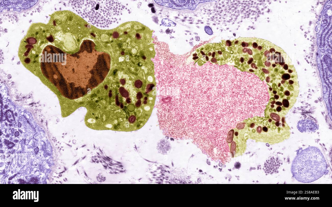 Pancreatic tissue. Coloured transmission electron micrograph (TEM) of a ...