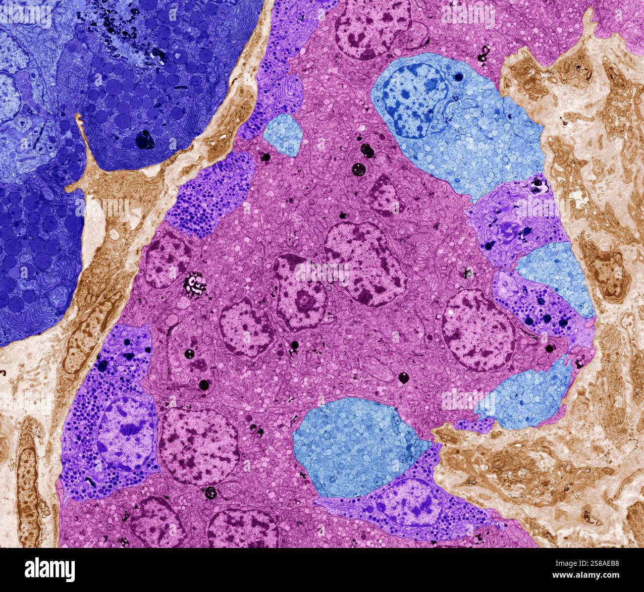 Pancreatic Islet of Langerhans. Coloured transmission electron ...