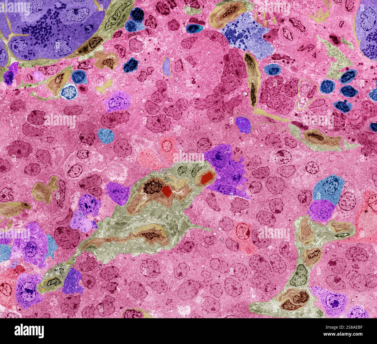 Pancreatic tissue. Coloured transmission electron micrograph (TEM) of a ...