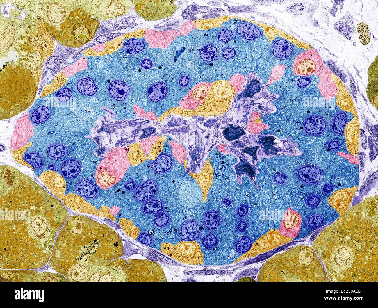 Pancreatic Islet of Langerhans. Coloured transmission electron ...
