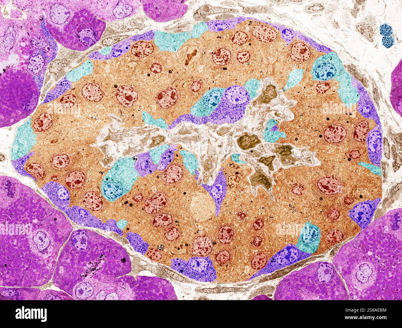 Pancreatic Islet of Langerhans. Coloured transmission electron ...