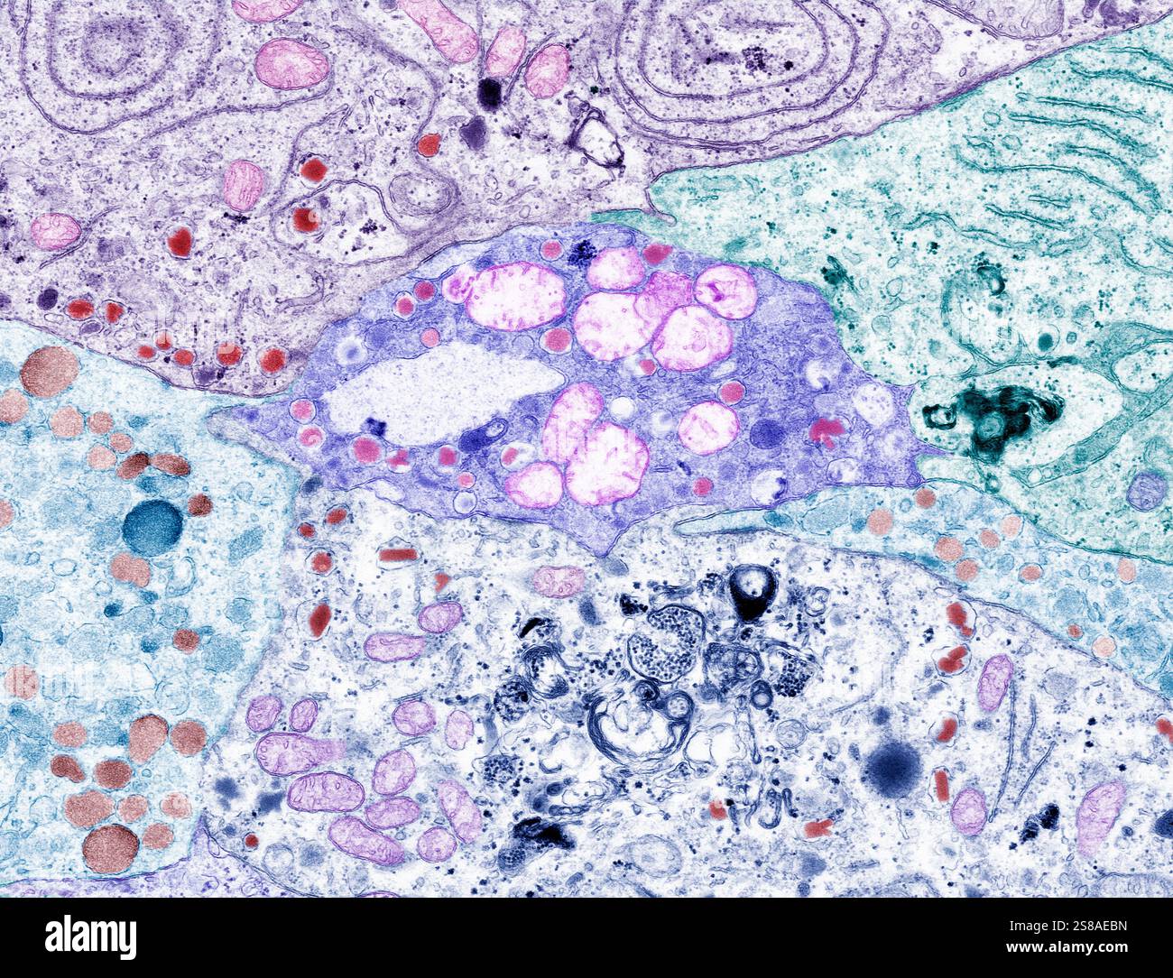 Pancreatic tissue. Coloured transmission electron micrograph (TEM) of a ...