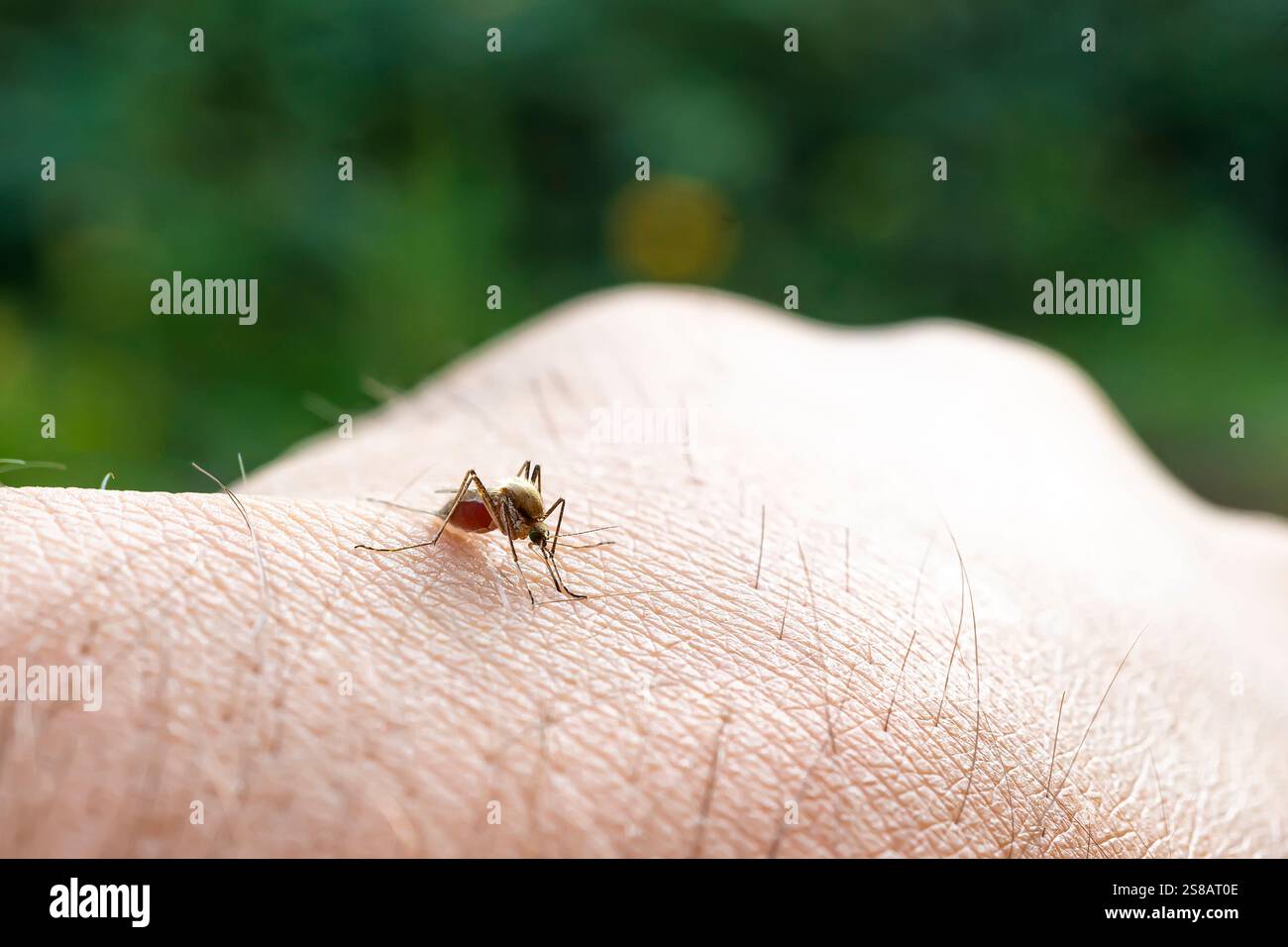 Dangerous Malaria Infected Mosquito Skin Bite. Leishmaniasis ...