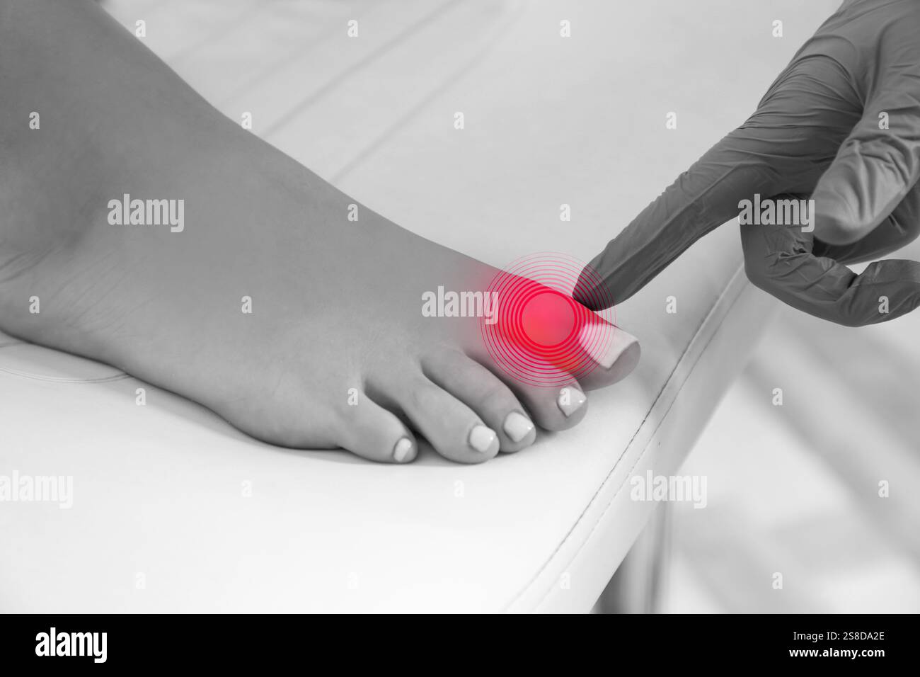 Joint inflammation. Doctor checking woman's foot at hospital, closeup ...