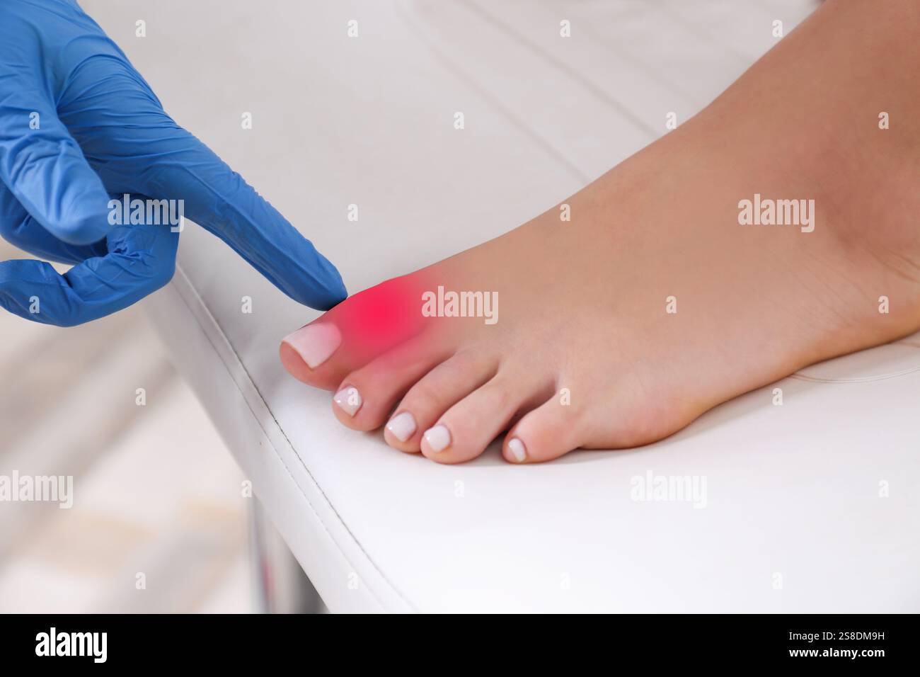Joint inflammation. Doctor checking woman's foot at hospital, closeup ...