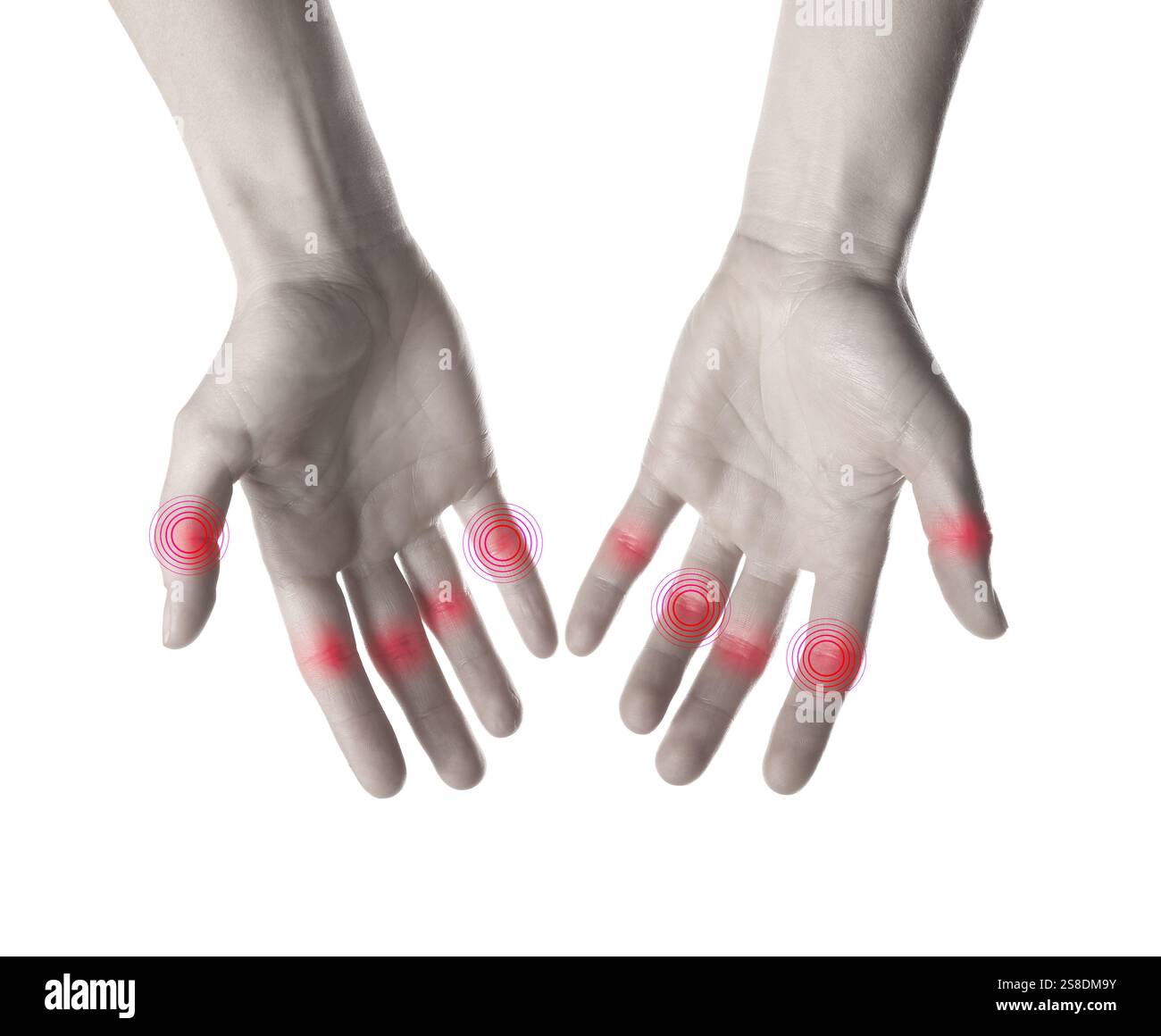 Woman with joint inflammation on white background, closeup. Toned in ...