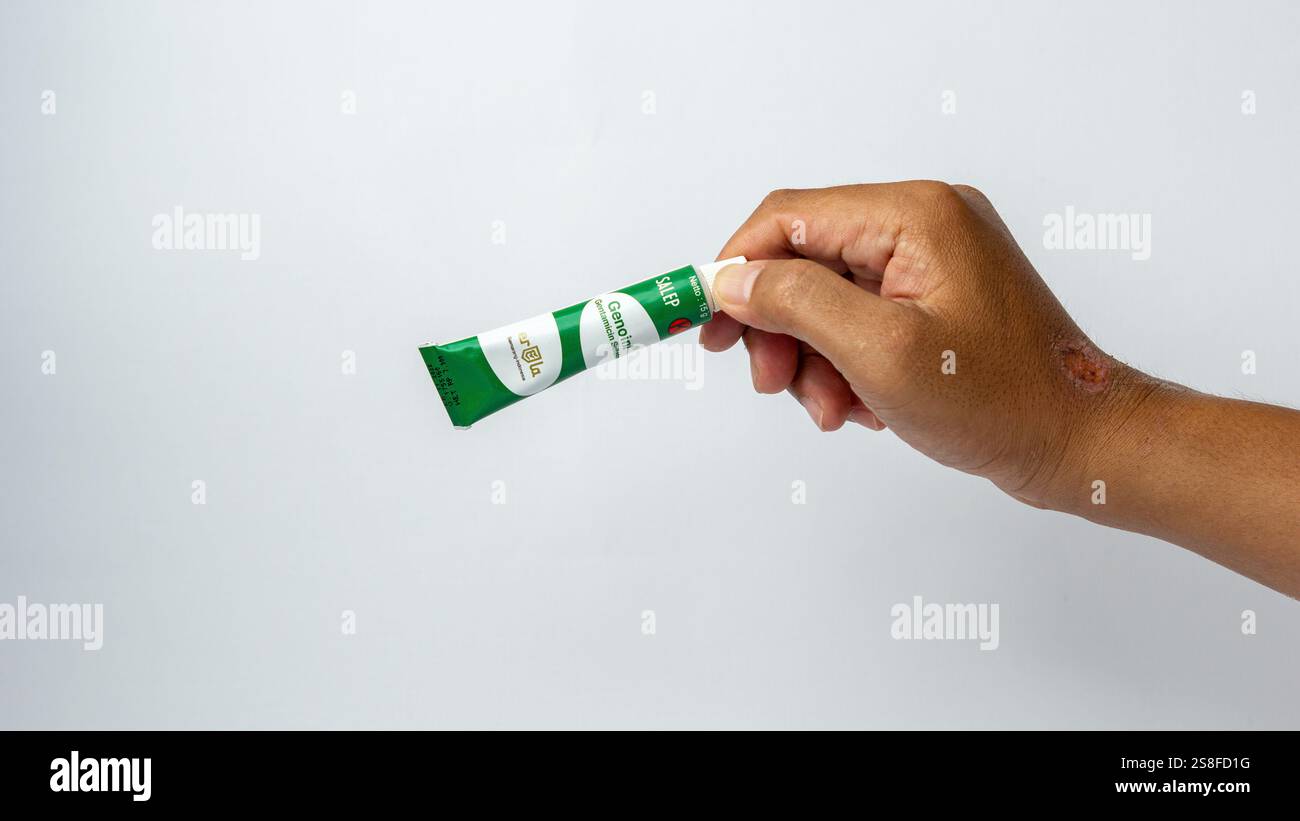 Hand holding genoint. Genoint is an eye drop, eye ointment and skin ...