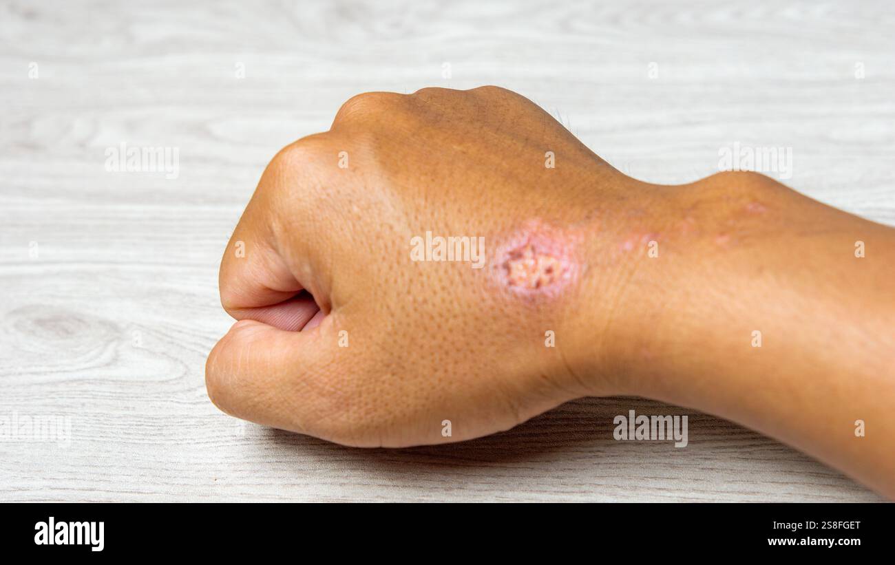 There is a scar on his hands. Hand with tanned color Stock Photo - Alamy