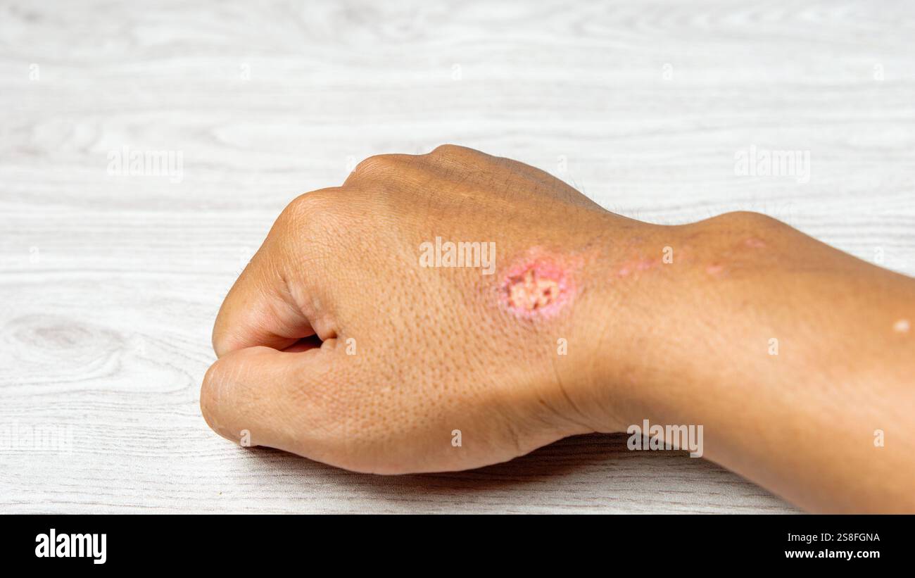 There is a scar on his hands. Hand with tanned color Stock Photo - Alamy