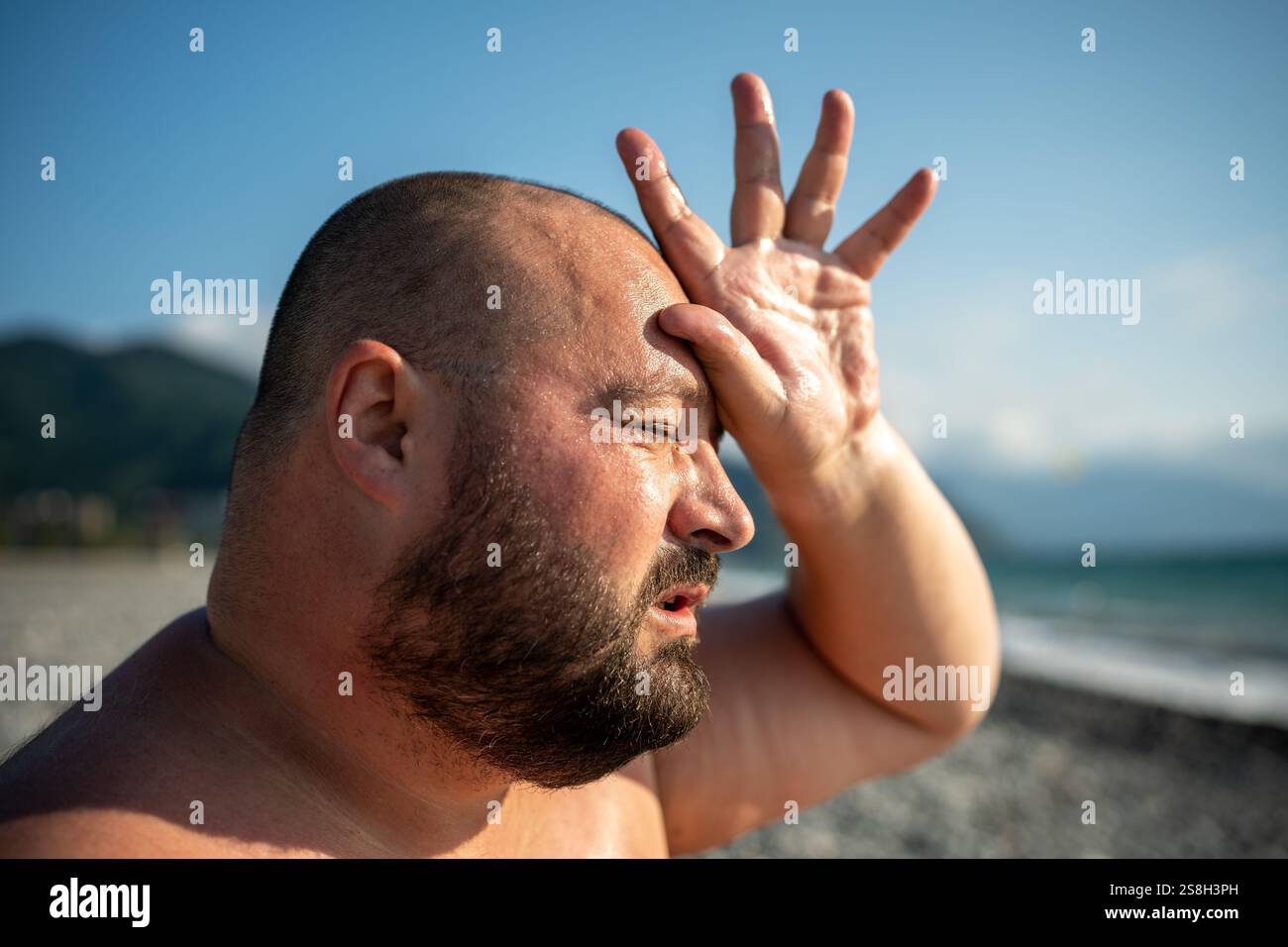 Heavyset man wipes sweat, shields head from sun after heatstroke on ...
