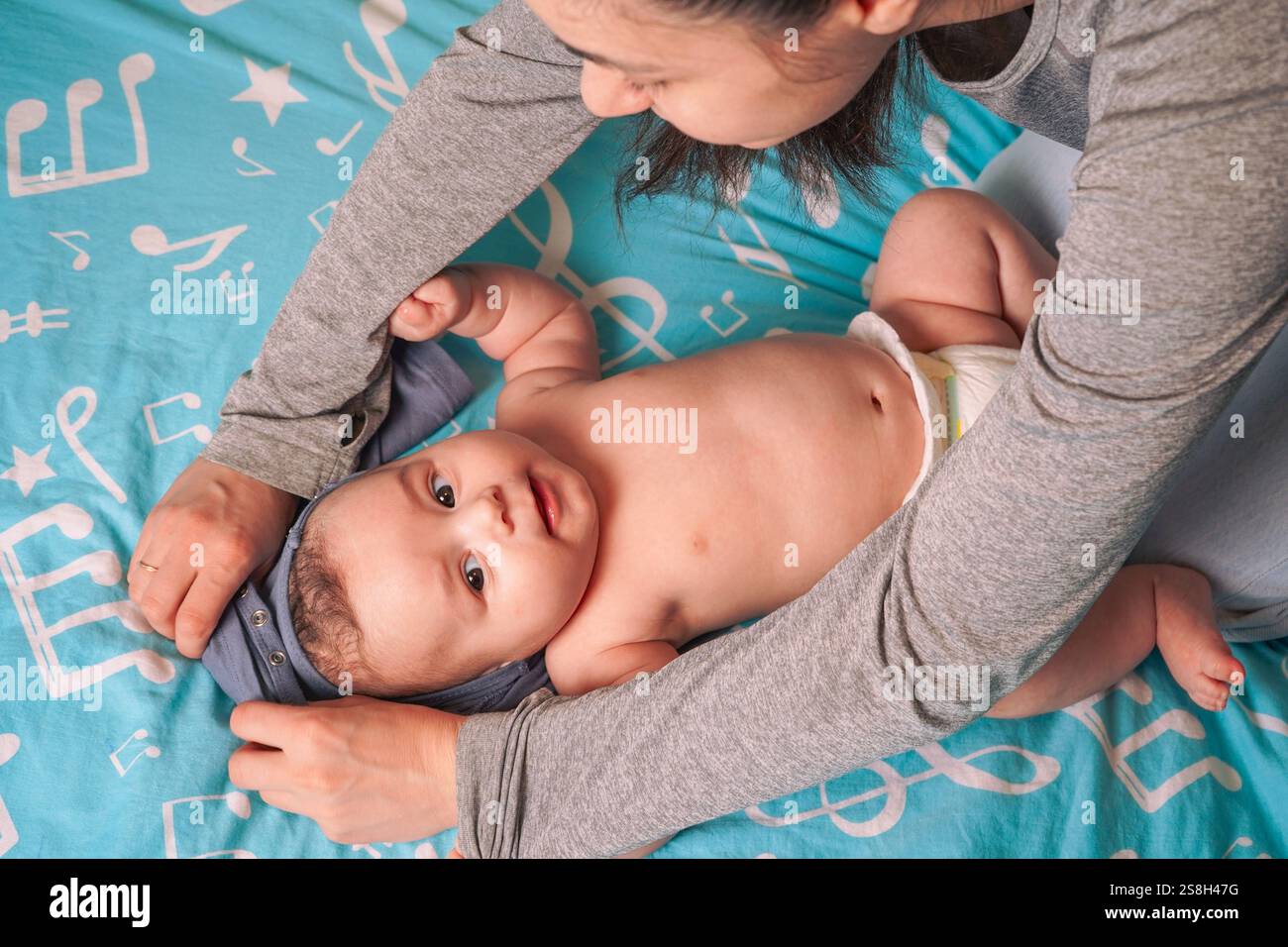 Seborrheic dermatitis on head of the baby. Newborn with seborrhea ...