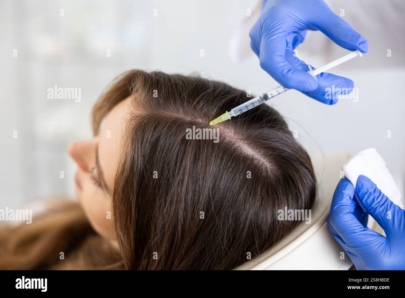 Hands of trichologist performing injections into scalp to female ...