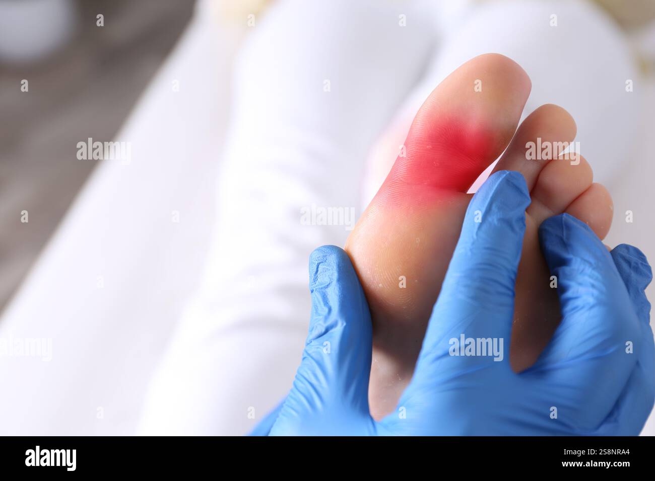 Joint inflammation. Doctor checking woman's foot at hospital, closeup ...