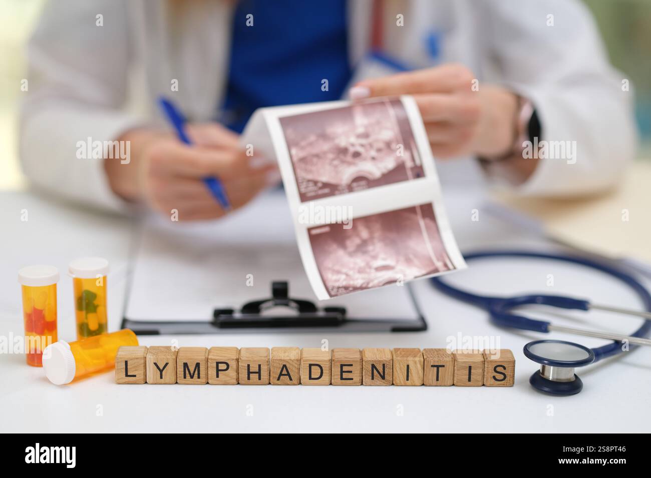 Overview of lymphadenitis diagnosis, treatment protocols, examination ...