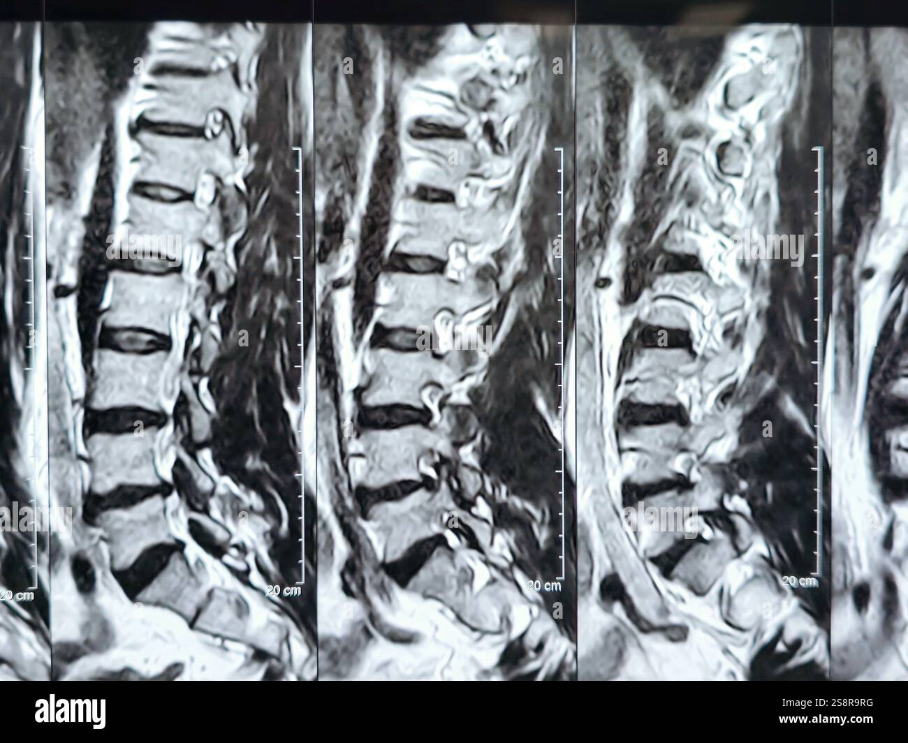 Magnetic resonance image shows hi-res stock photography and images - Alamy