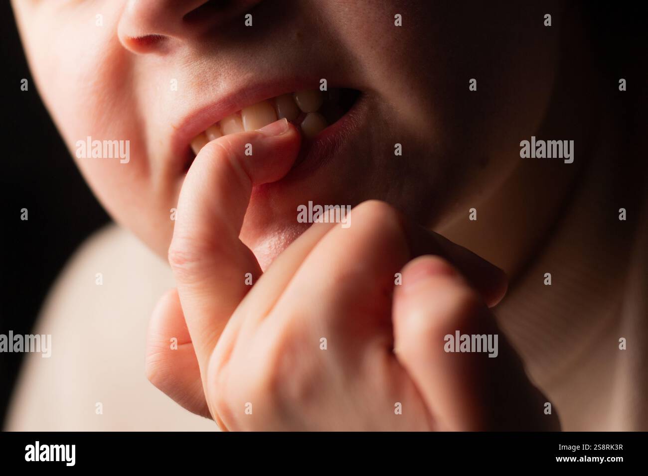 Nail biting. Woman biting fingernails. Behavioral disorder ...