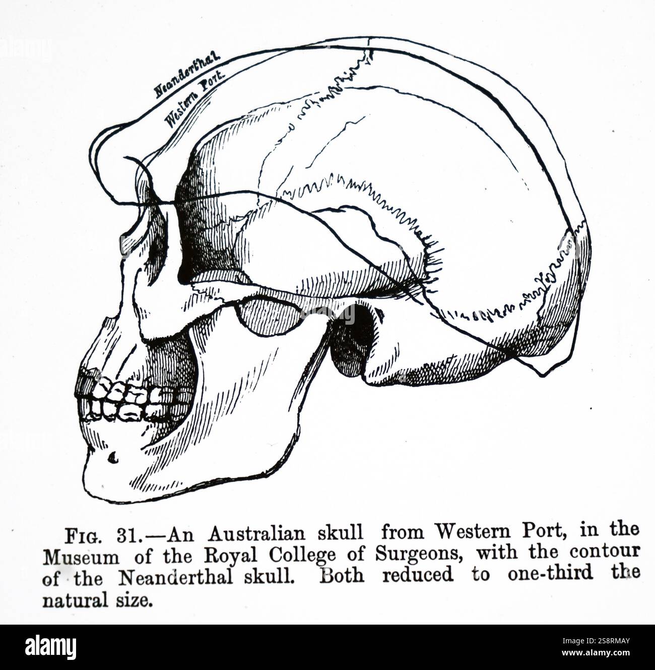 Illustration depicting the comparison of human skulls. Const. is a ...