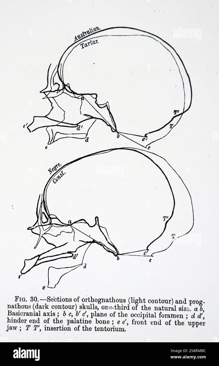 Illustration depicting the comparison of human skulls. Const. is a ...