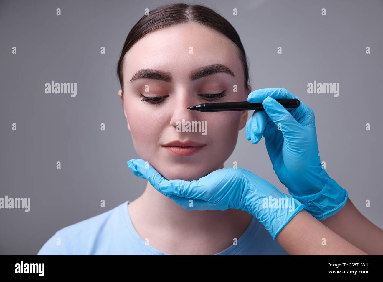 Doctor drawing marks on patient's nose for plastic surgery operation ...