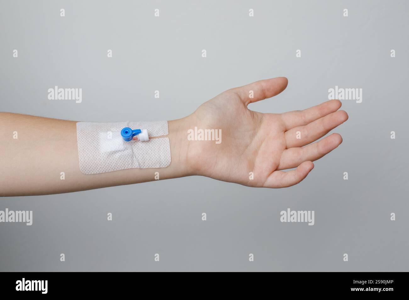 Female hand with Peripheral venous catheter on white background Stock ...