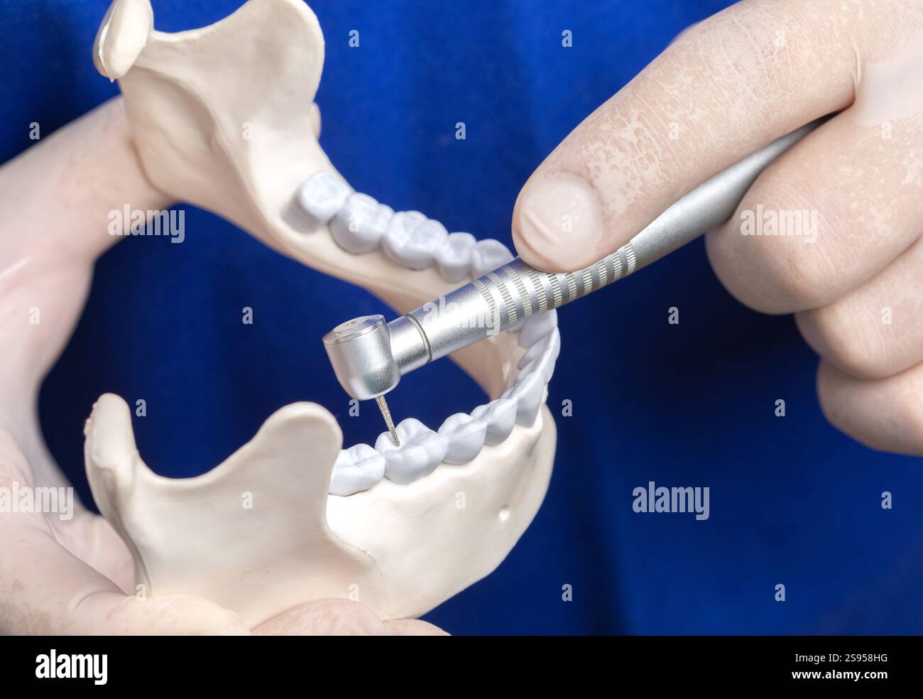 Treatment of toothache. Doctor dentist holds a plastic human skull and ...