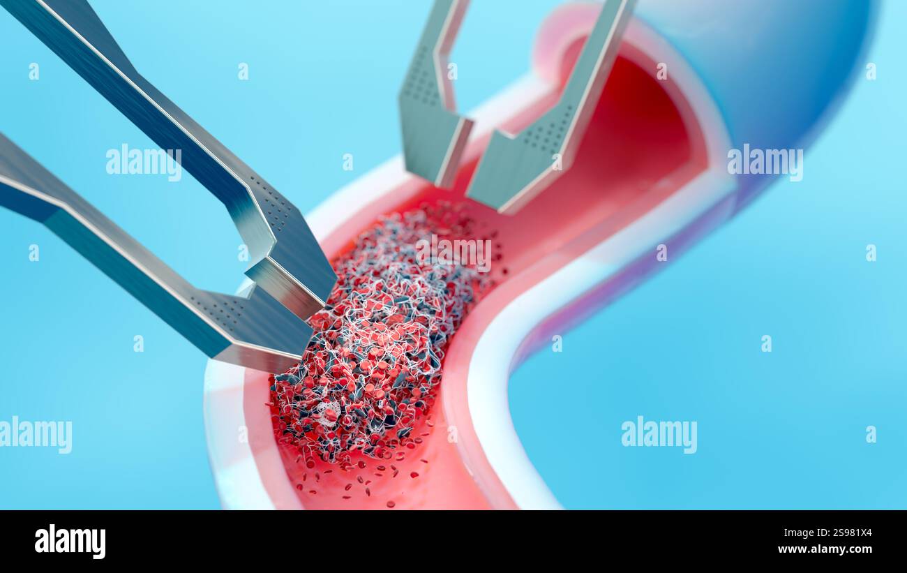 Conceptual illustration of microelectromechanical system (MEM ...