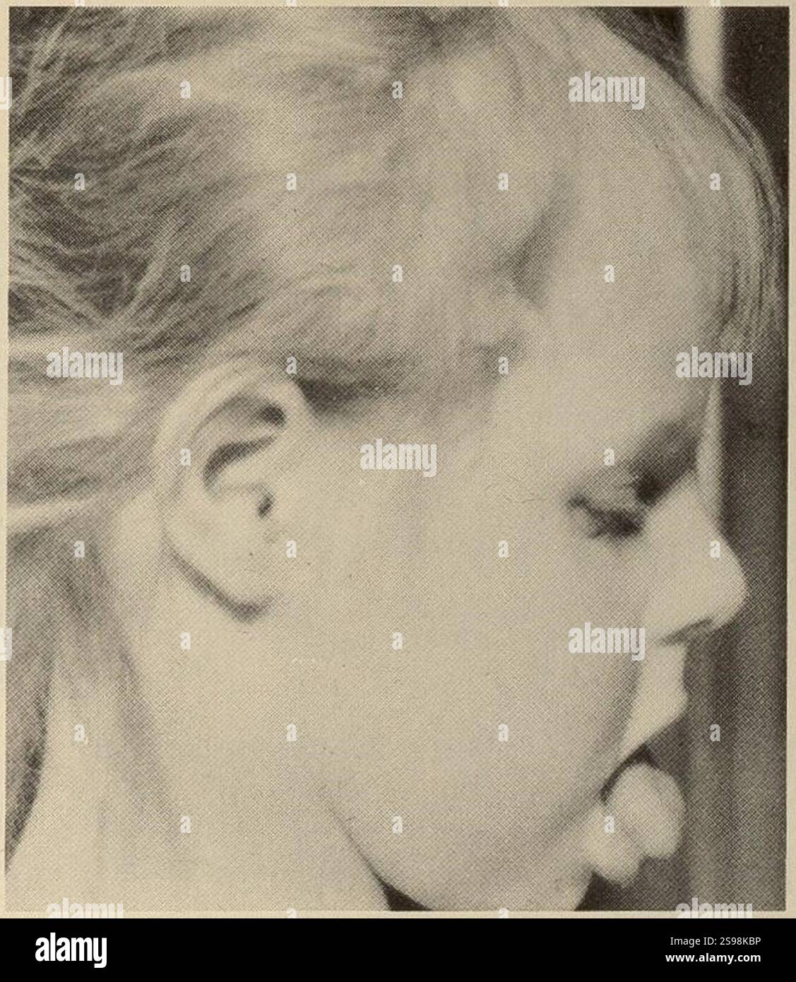 Happy Puppet Syndrome 1 Stock Photo - Alamy