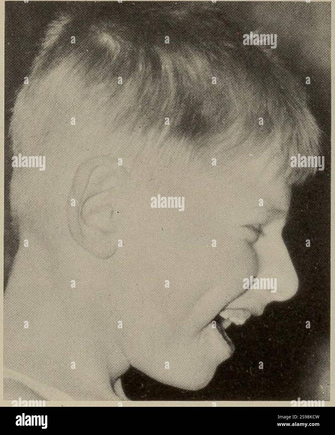 Happy Puppet Syndrome 2 Stock Photo - Alamy