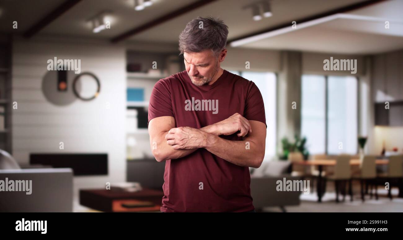 Man With Itchy Skin. Allergy Or Psoriasis Stock Photo - Alamy