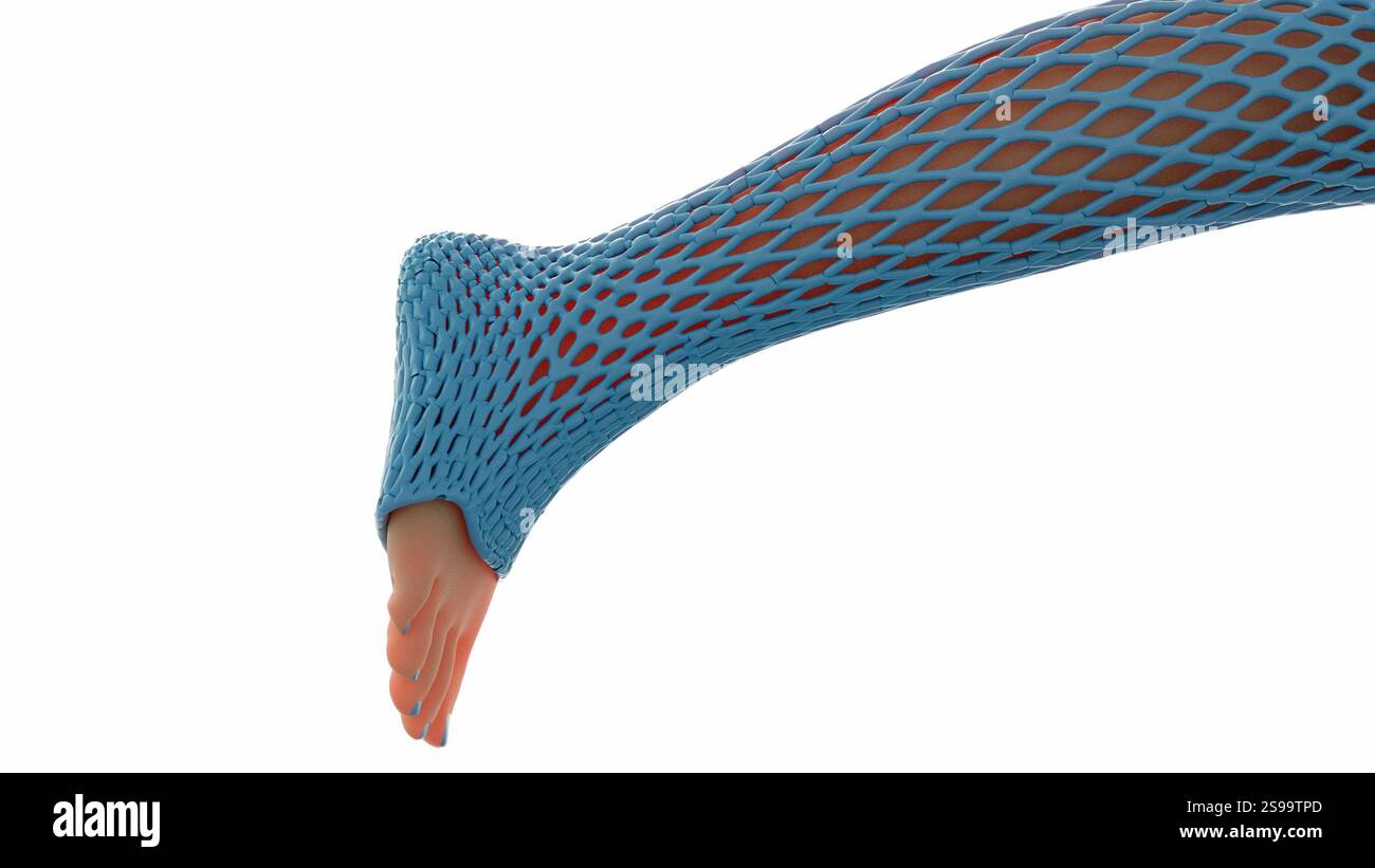 A 3d rendering of futuristic concept for orthopedic casts and open ...