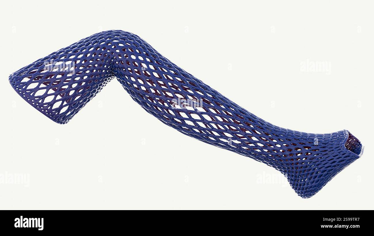 A 3d rendering of futuristic concept for orthopedic casts and open ...