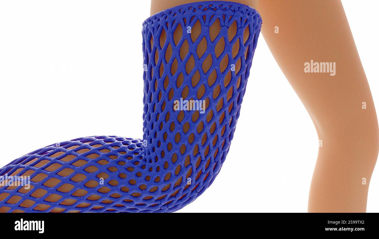A 3d rendering of futuristic concept for orthopedic casts and open ...