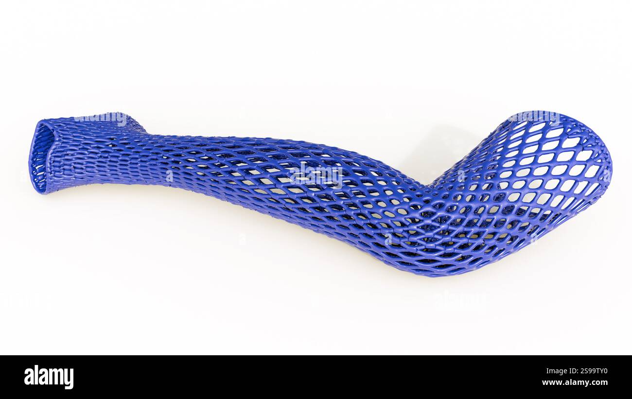 A 3d rendering of futuristic concept for orthopedic casts and open ...