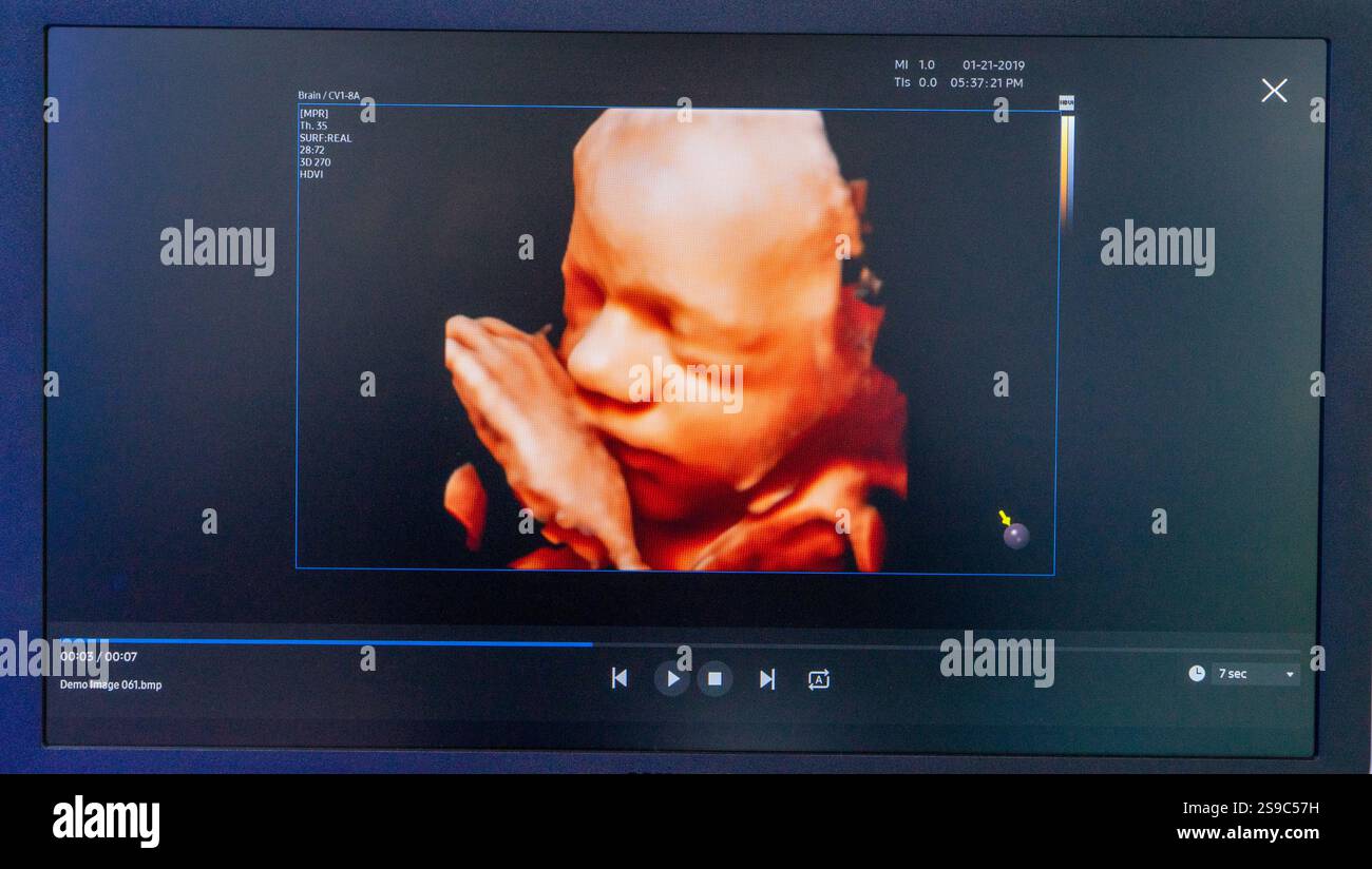 A child in the womb on the screen of an ultrasound machine. Modern ...