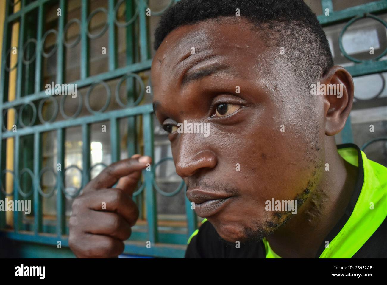 Ateasong Belts Tajoah shows a bullet scar on his neck during an ...